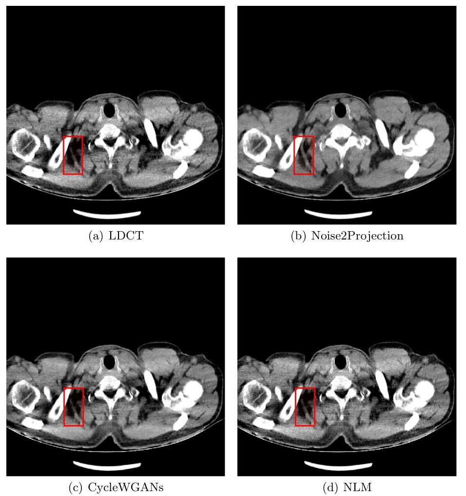 Low-dose CT reconstruction by self-supervised learning in the ...