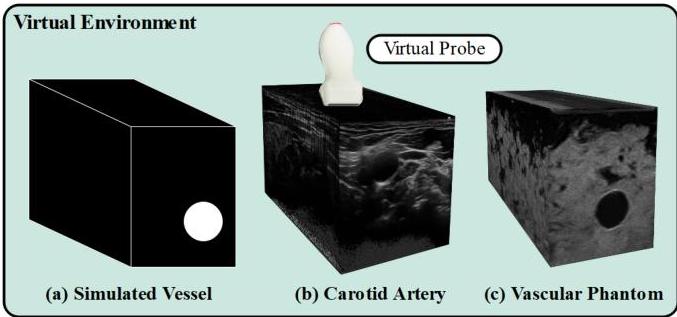 VesNet-RL: Simulation-based Reinforcement Learning for Real-World US ...