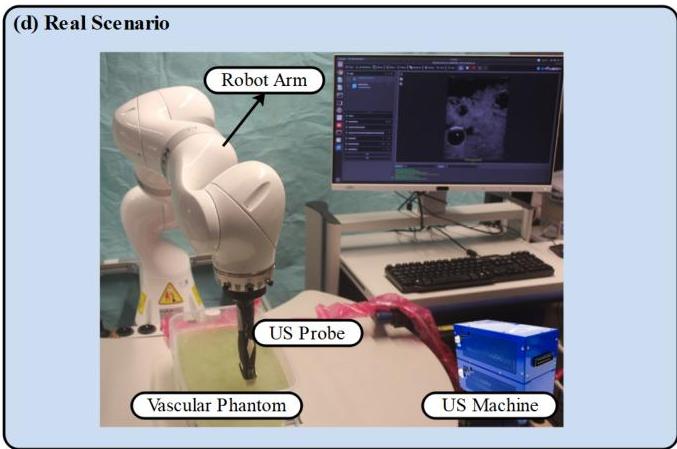 VesNet-RL: Simulation-based Reinforcement Learning for Real-World US ...