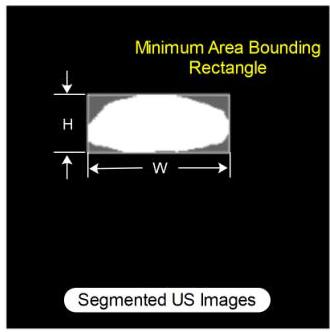 VesNet-RL: Simulation-based Reinforcement Learning for Real-World US ...