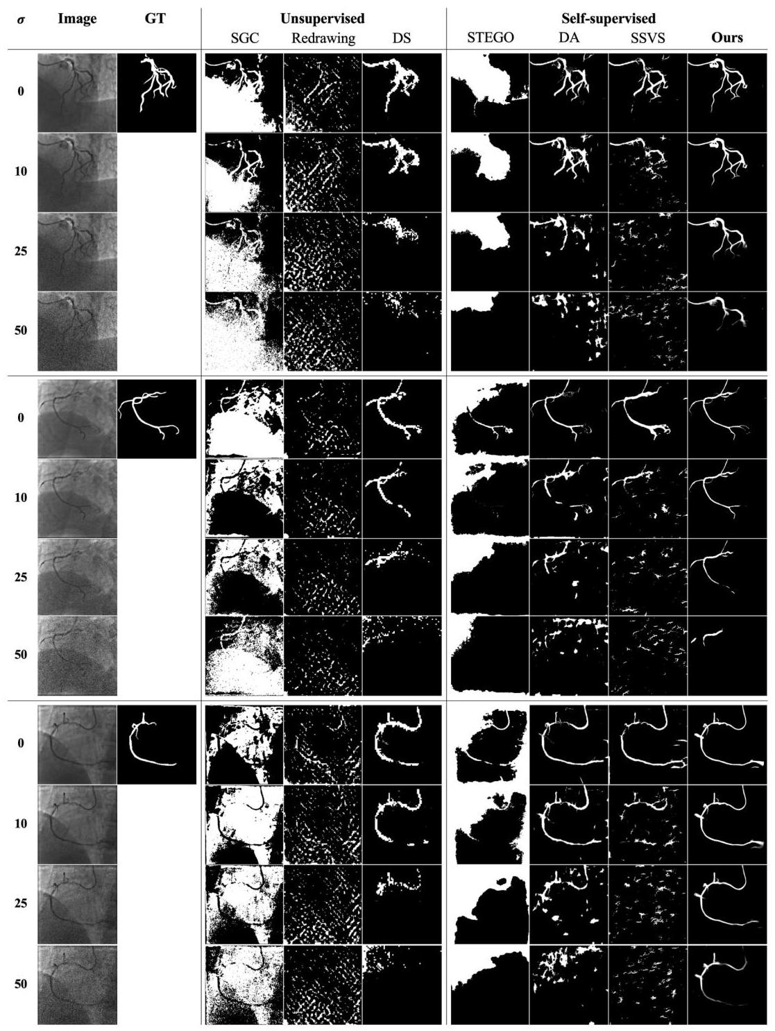 Diffusion Adversarial Representation Learning for Self-supervised Vessel Segmentation | alphaXiv