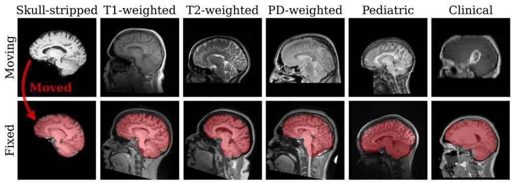 Anatomy-aware and acquisition-agnostic joint registration with ...