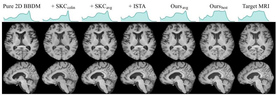 Slice-Consistent 3D Volumetric Brain CT-to-MRI Translation with 2D ...