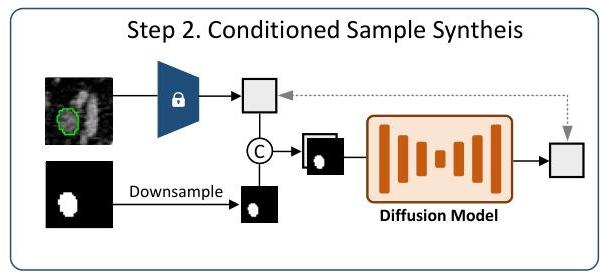 LN-Gen: Rectal Lymph Nodes Generation via Anatomical Features | alphaXiv