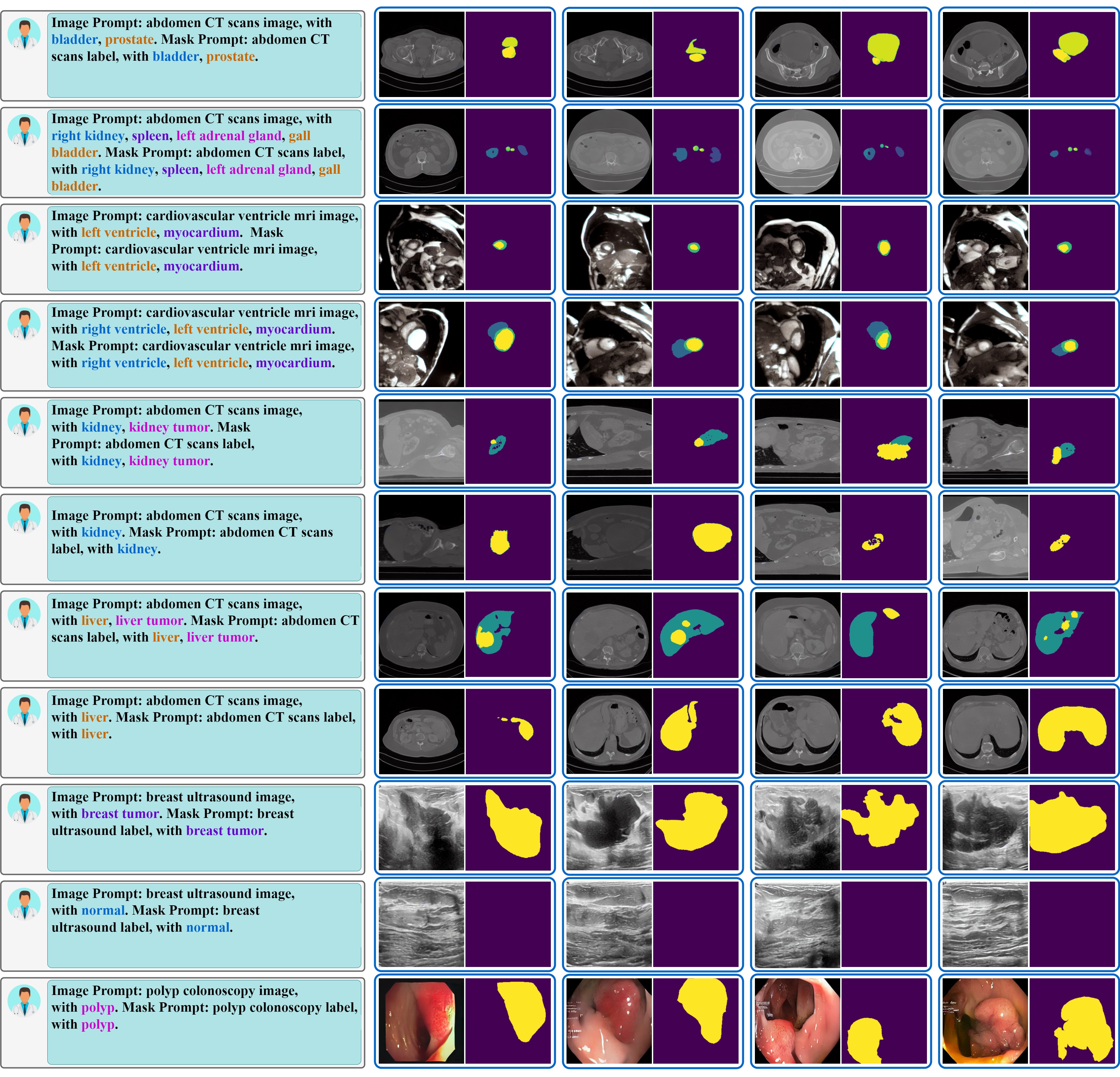 MedSegFactory: Text-Guided Generation of Medical Image-Mask Pairs ...