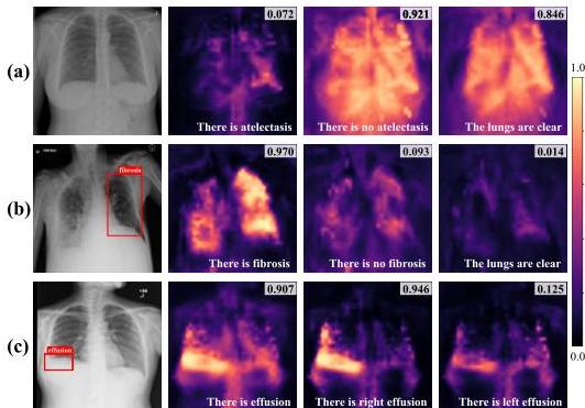 RadZero: Similarity-Based Cross-Attention for Explainable Vision ...