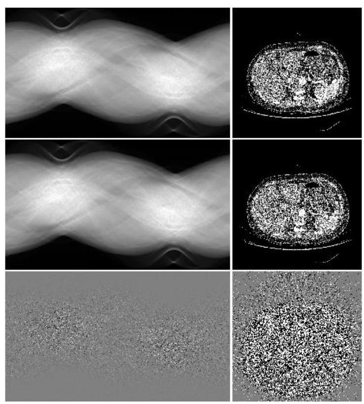 Zero-Shot Low-dose CT Denoising via Sinogram Flicking | alphaXiv