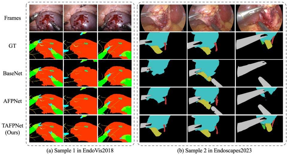 Temporal Propagation of Asymmetric Feature Pyramid for Surgical Scene ...