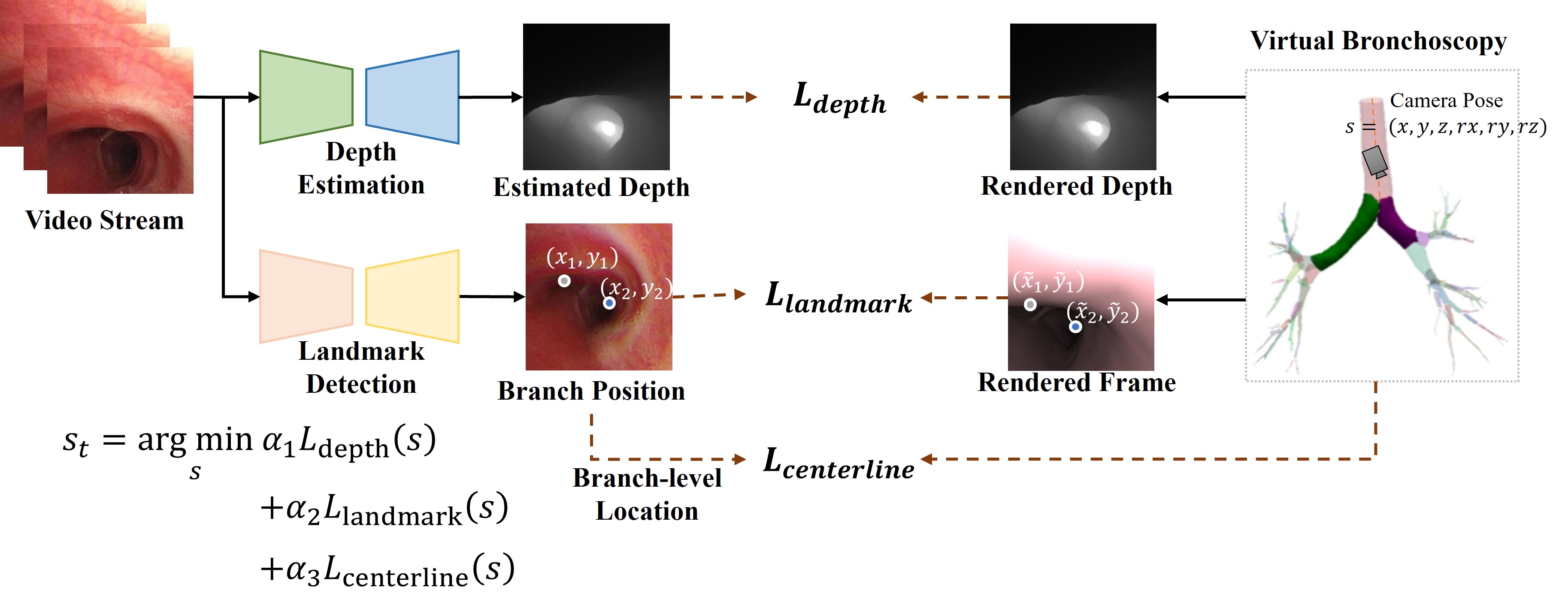 Harnessing Foundation Models for Robust and Generalizable 6-DOF Bronchoscopy Localization | alphaXiv