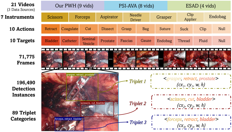 ProstaTD: Bridging Surgical Triplet from Classification to Fully ...