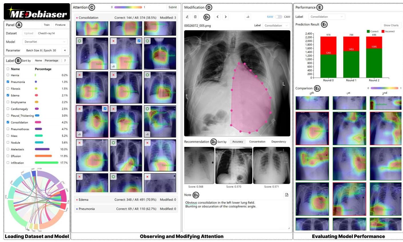 MEDebiaser: A Human-AI Feedback System for Mitigating Bias in Multi ...