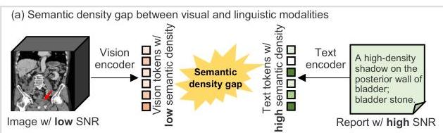 Boosting Vision Semantic Density with Anatomy Normality Modeling for ...