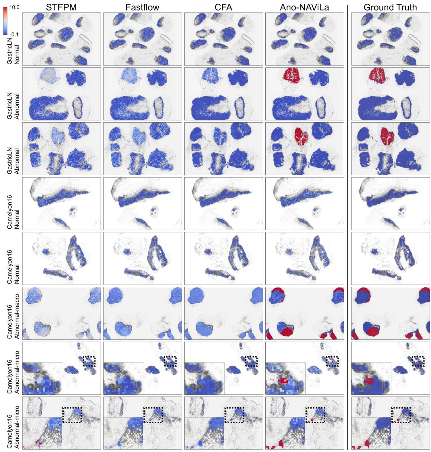 Normal and Abnormal Pathology Knowledge-Augmented Vision-Language Model ...