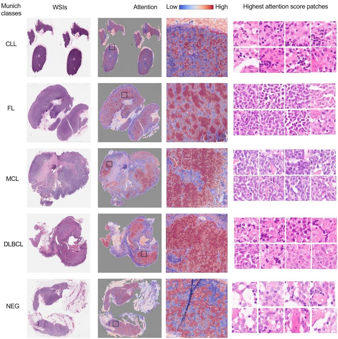 A Multicenter Benchmark of Multiple Instance Learning Models for ...