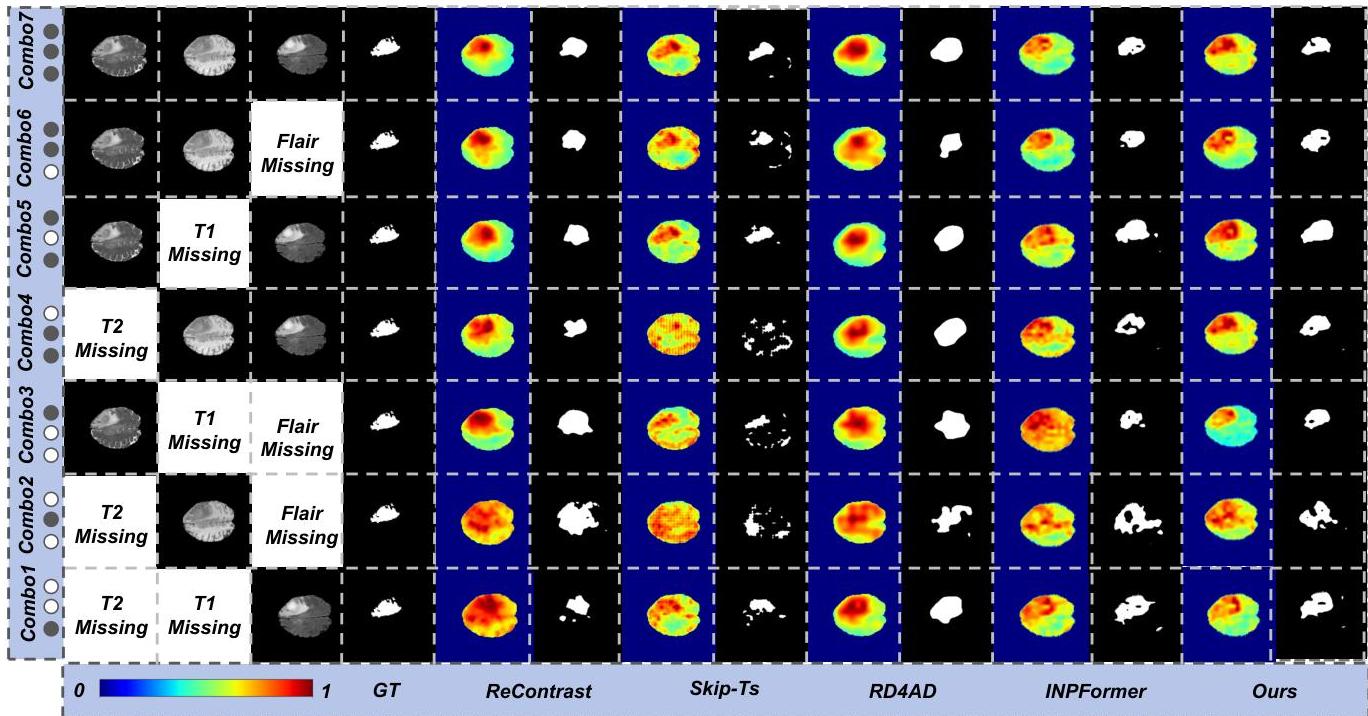 AnyAD: Unified Any-Modality Anomaly Detection in Incomplete Multi ...