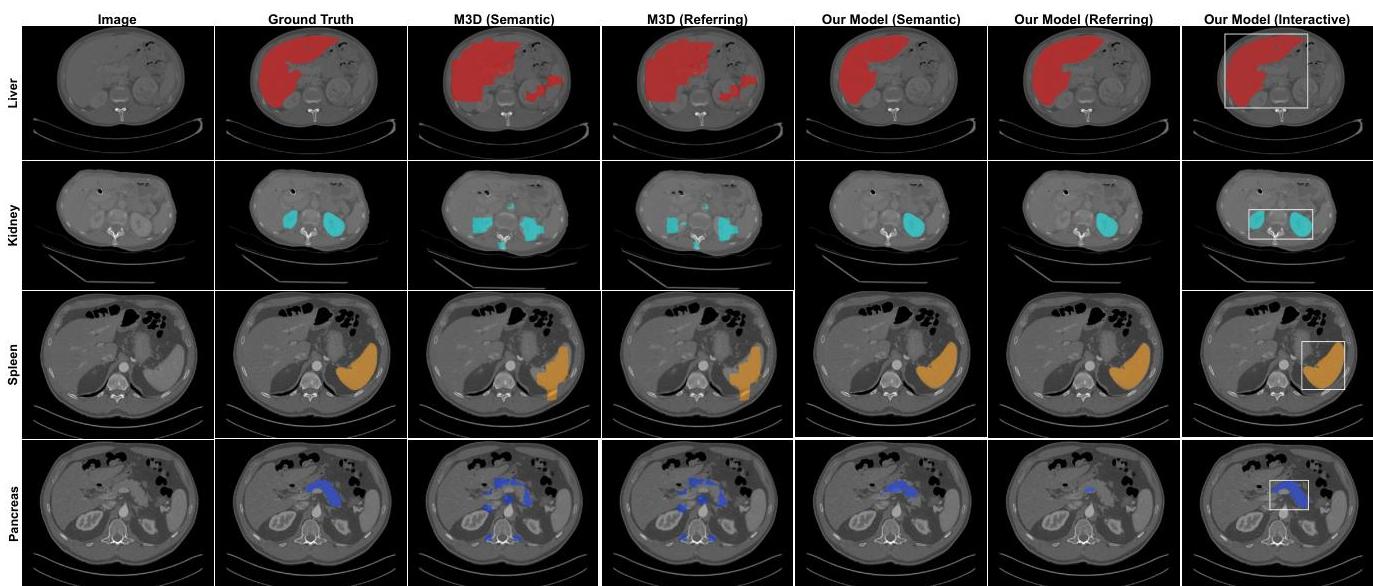 MedVL-SAM2: A unified 3D medical vision-language model for multimodal ...